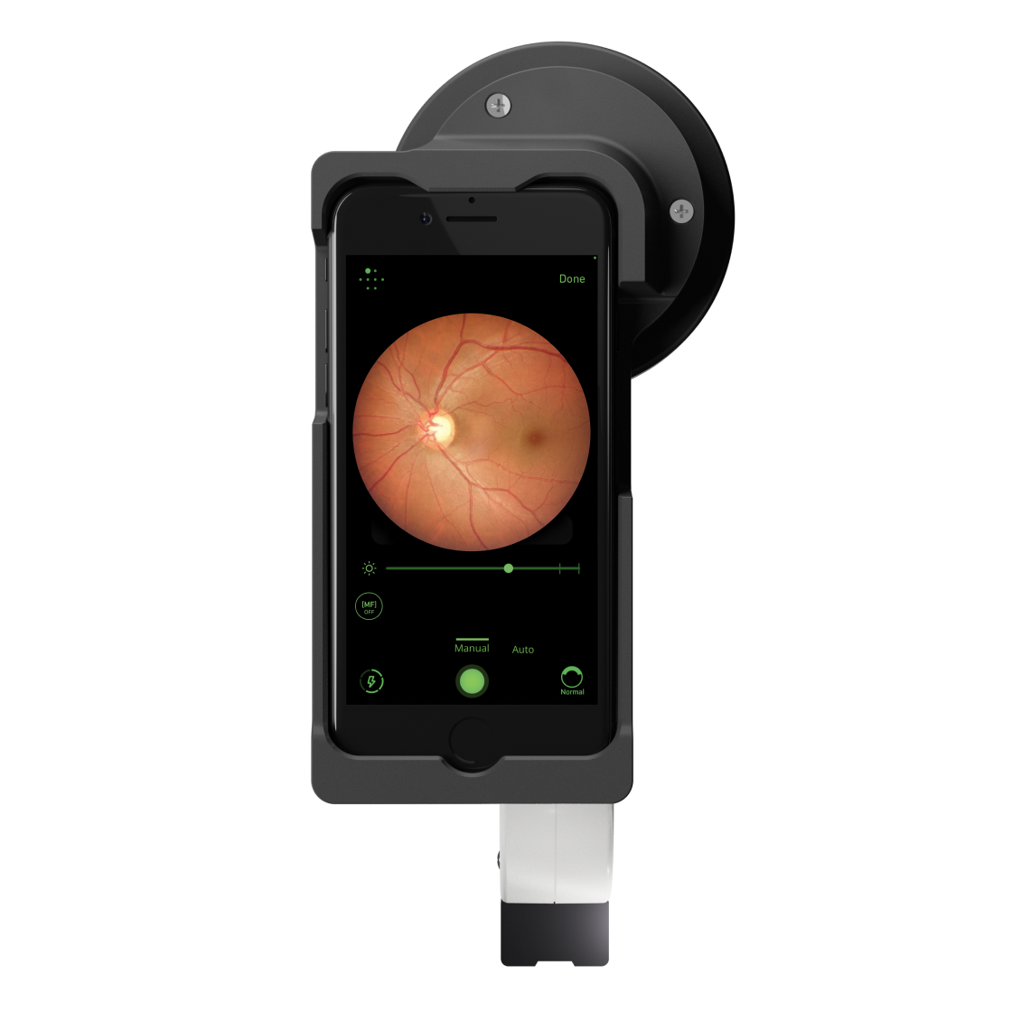 Remidio FOP NM-10 | Non Mydriatic Hand Held Fundus Camera